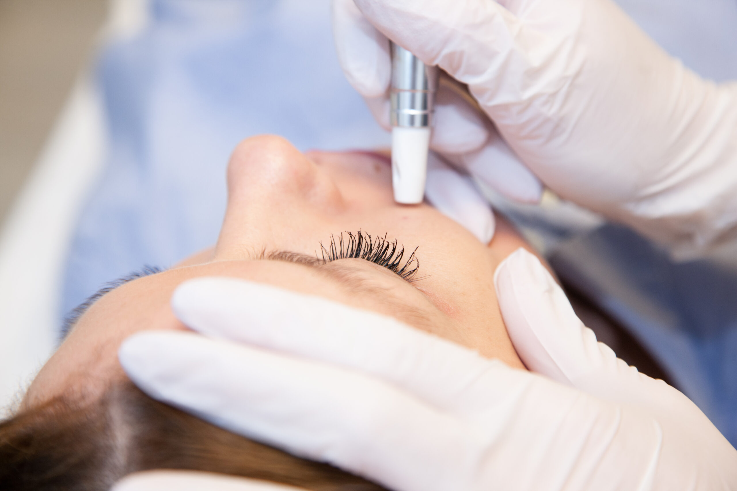 Fractional needle round 42 nål - Art by Nikka Academy